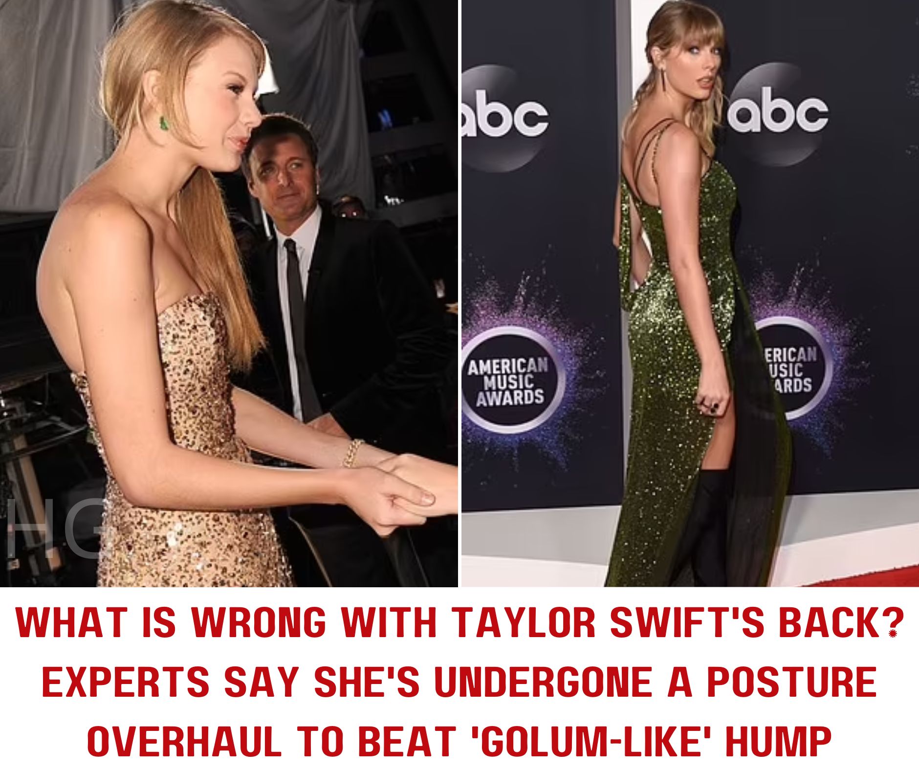 What IS wrong with Taylor Swift's back? Experts say she's undergone a ...