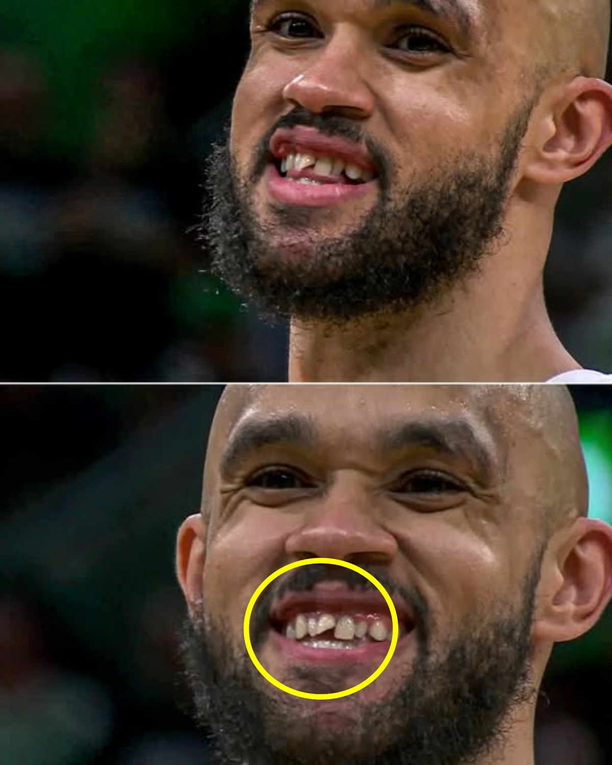 "Derrick White and His Hilarious Confession: Losing Teeth for a Celtics ...